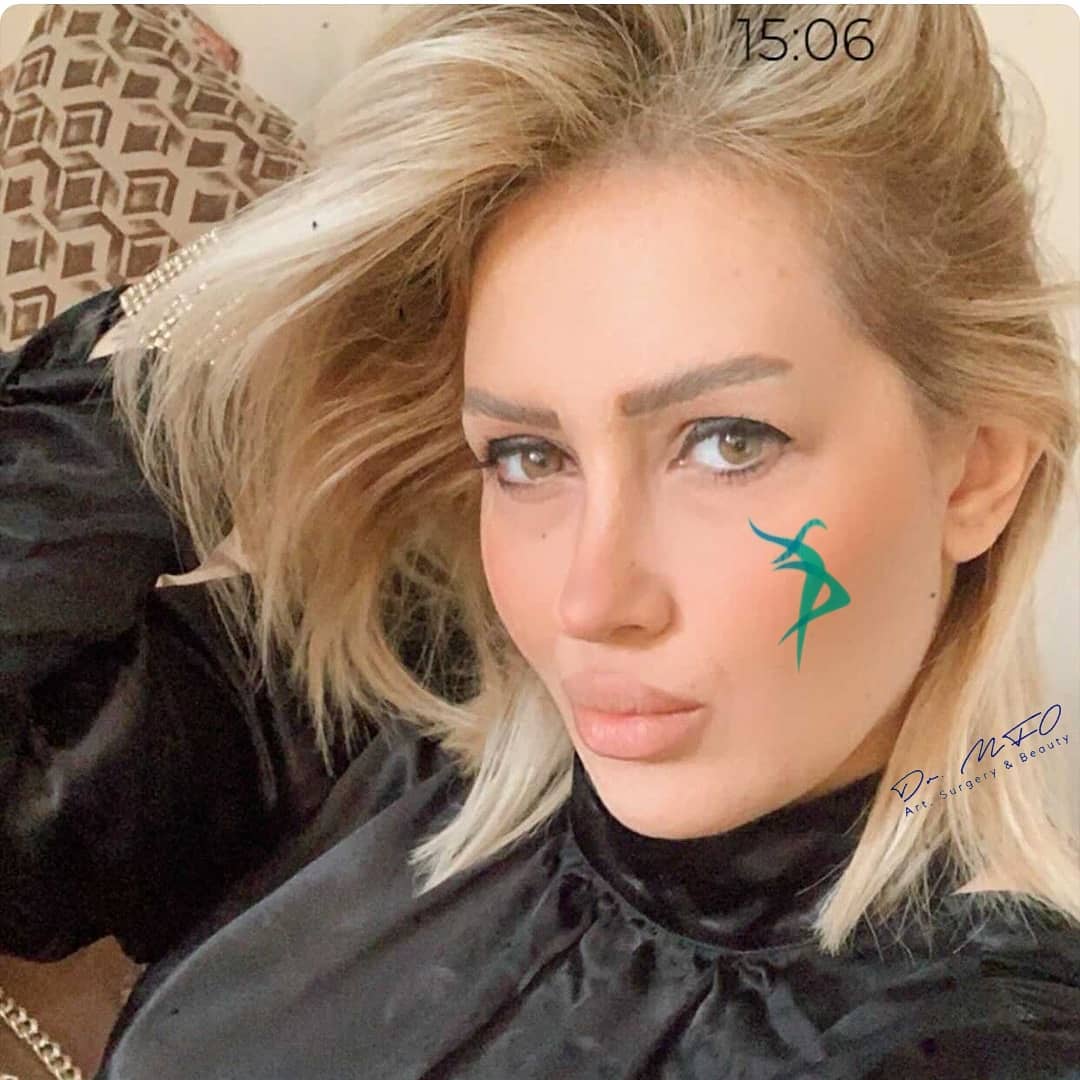 Contact Now - Dr. MFO - FFS Surgeon in Turkey