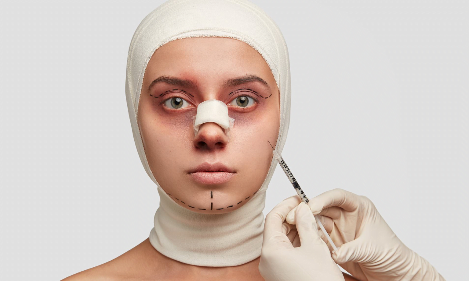 Full Facial Feminization Surgery in 2025: Costs, Recovery, and Results