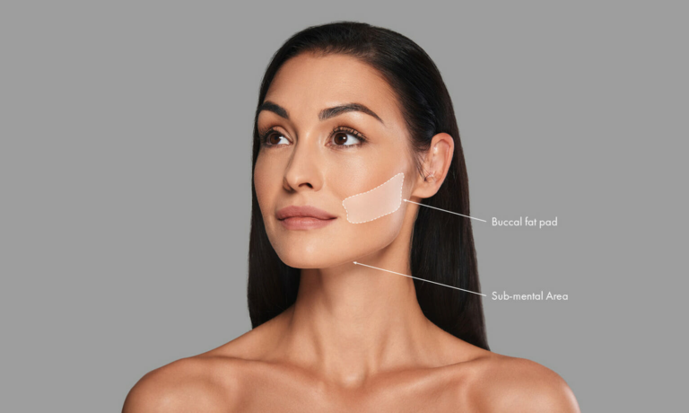 MTF Facial Feminization: Buccal Fat Removal Benefits