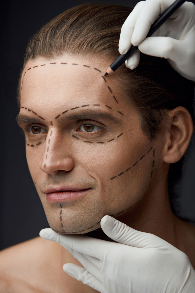 My Forehead Seems Small – Can Facial Mascululinization Surgery Help?