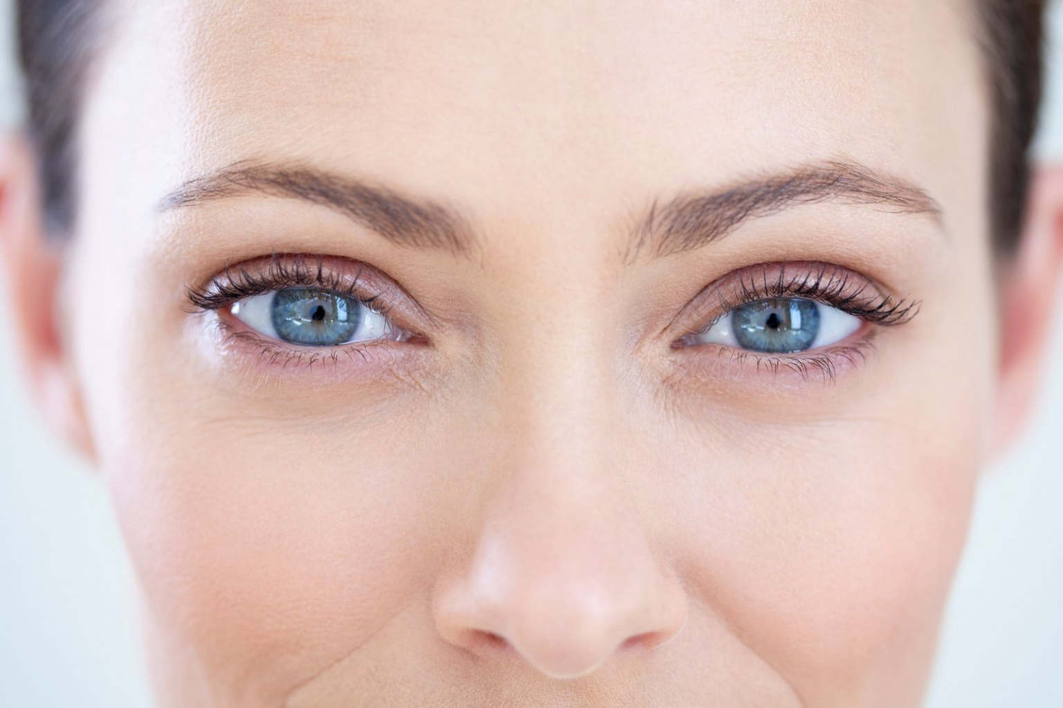 What is Negative Canthal Tilt? 4 Powerful Facts You Need to Know!