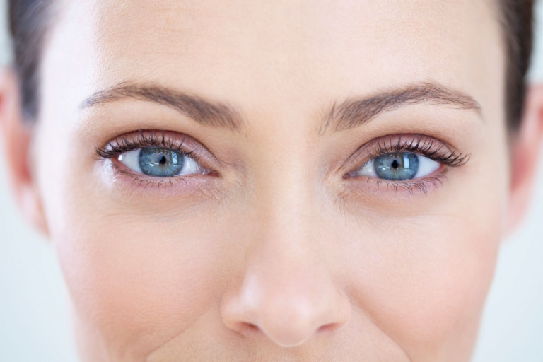 What is Negative Canthal Tilt? 4 Powerful Facts You Need to Know!