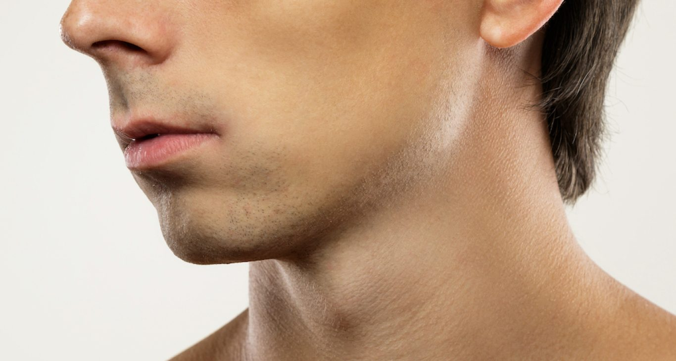 Wie kann man die Größe des Adamsapfels verringern?