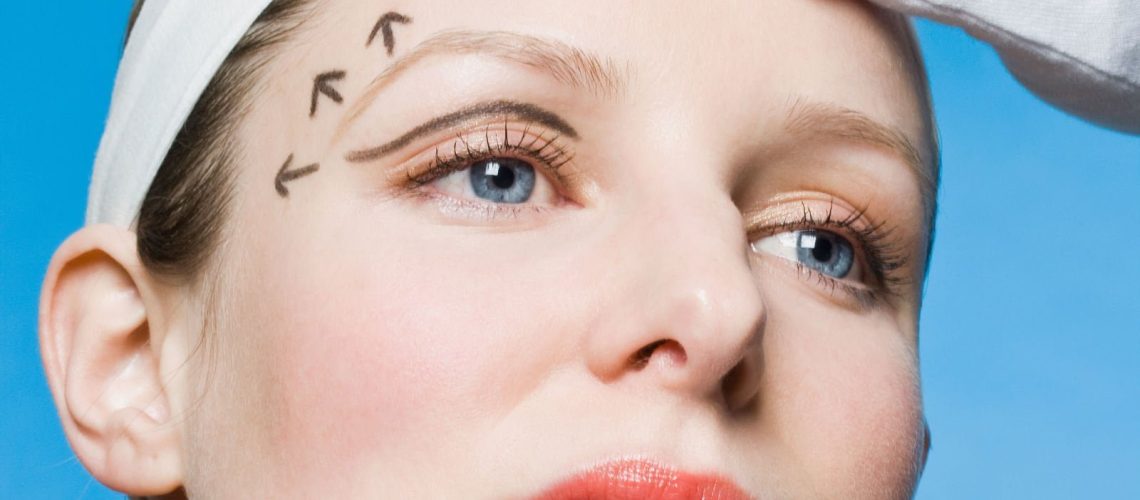 MTF Brow Lift: Can I Combine it with Other Facial Feminization Procedures?