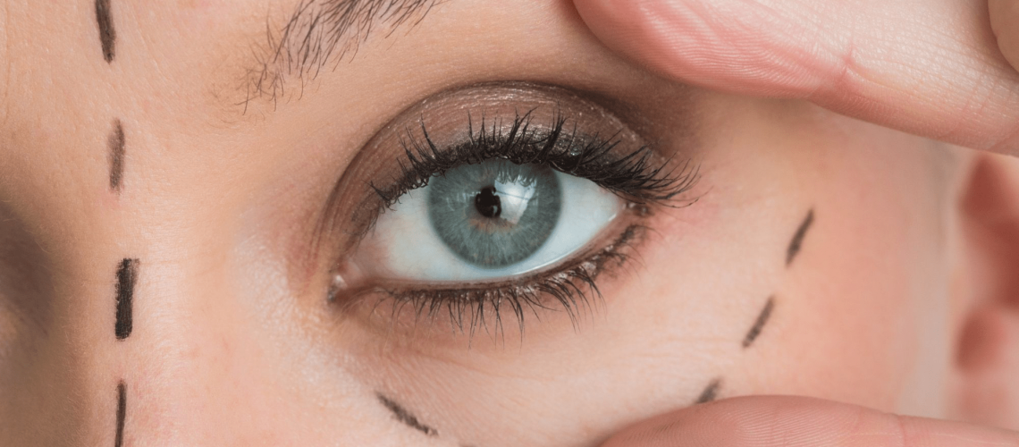 Cat Eye Surgery Prices in Turkey: Why Should You Choose Turkey? - Dr. MFO